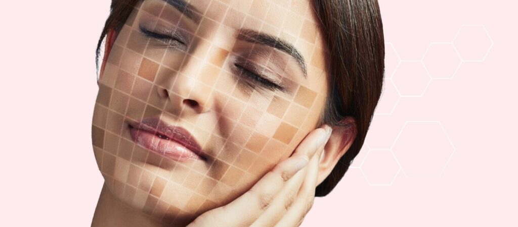 Uneven Skin Texture - Skintec