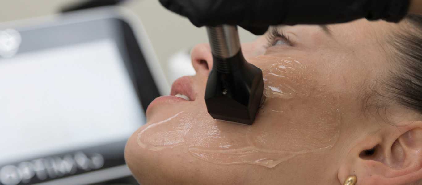 Forma Radio Frequency by Inmode - Skintec